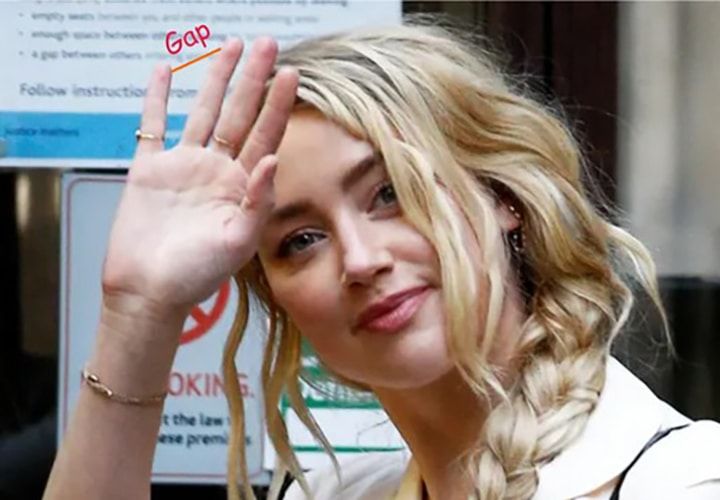 Gap Between Fingers: A Quick And Easy Guide To Understand Their ...